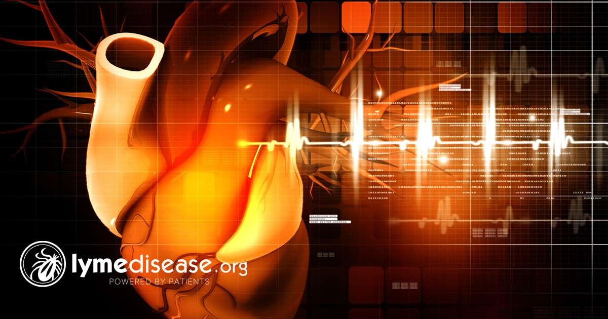 Lyme Carditis: Pathophysiology and Clinical Management