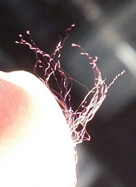 February is Morgellons Awareness Month